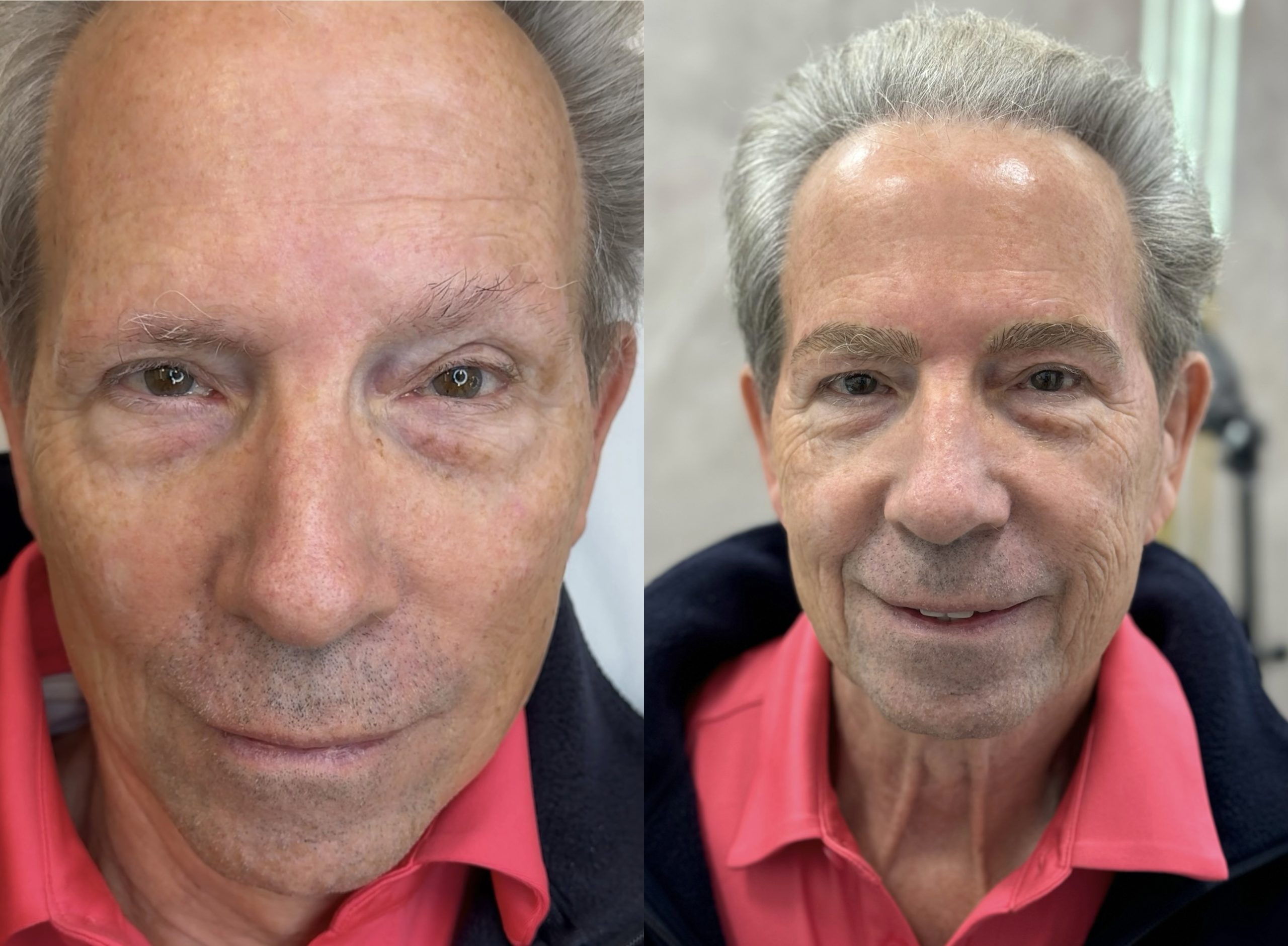 Expert Microblading for Men Best in USA Washington DC DMV Area